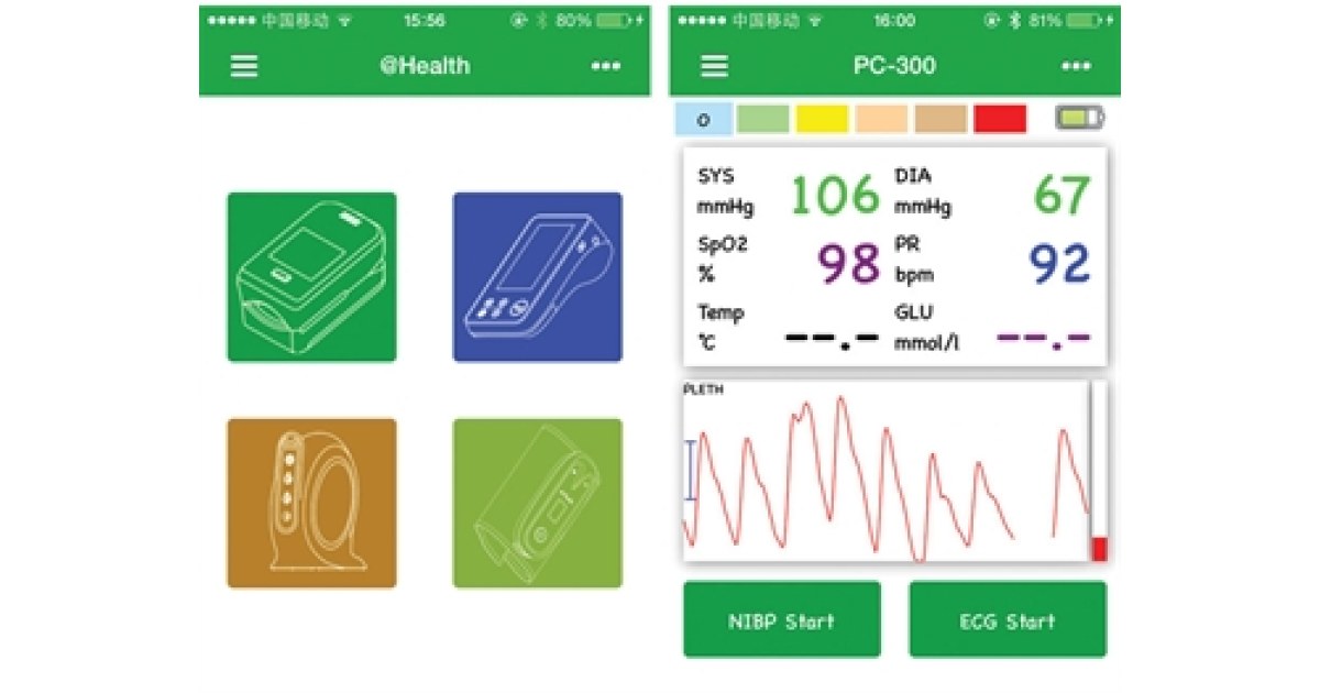 Spot Check Vital Signs Monitor with Pulse Oximetry & Thermometer PC-303 ...