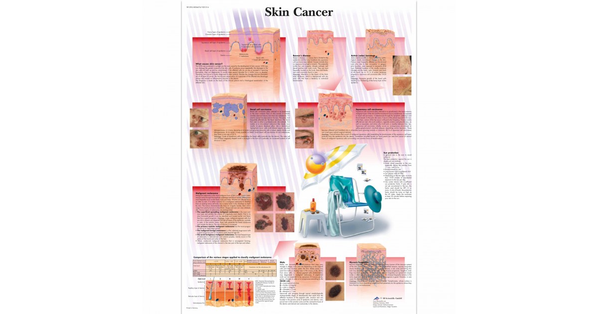 Skin cancer poster | Δίγκας Γ. Ιατρικά