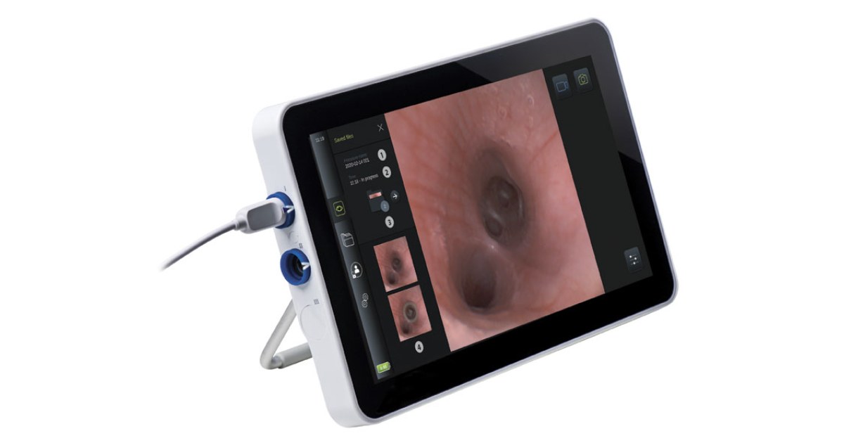 Portable full HD-Monitor AMBU® AVIEW™ 2 ADVANCE | Δίγκας Γ. Ιατρικά